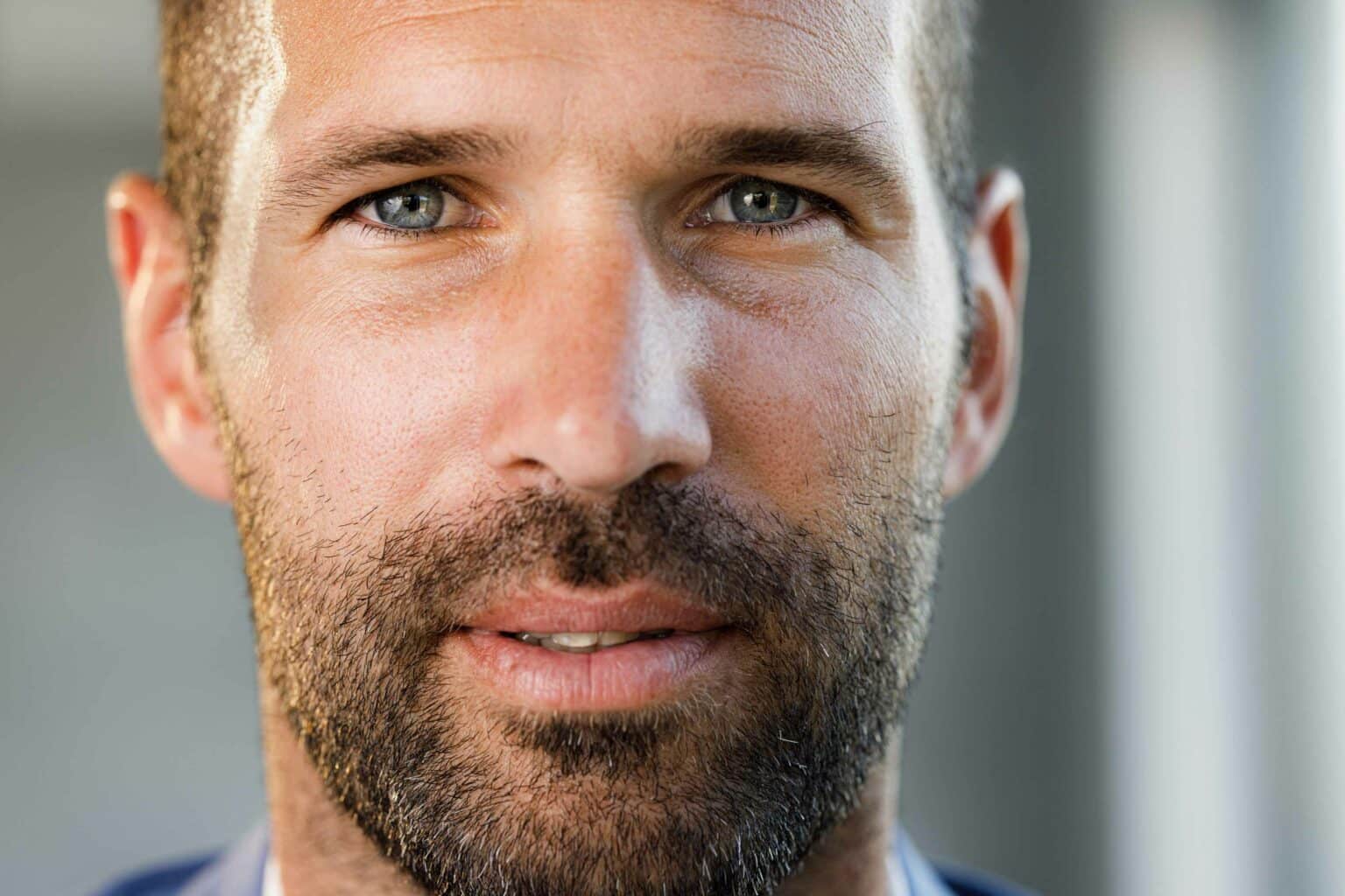 Epilation laser de la barbe | Dr Christine Luneau | Aix-en-Provence